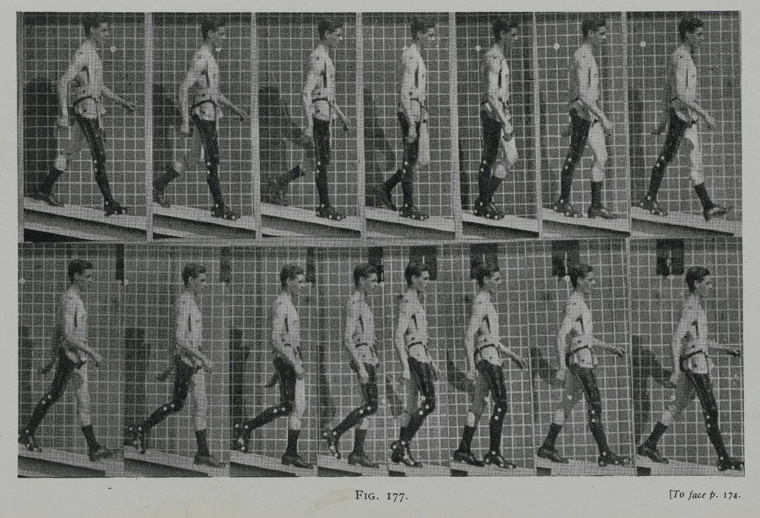 Advancements in the Technology of Prosthesis Health